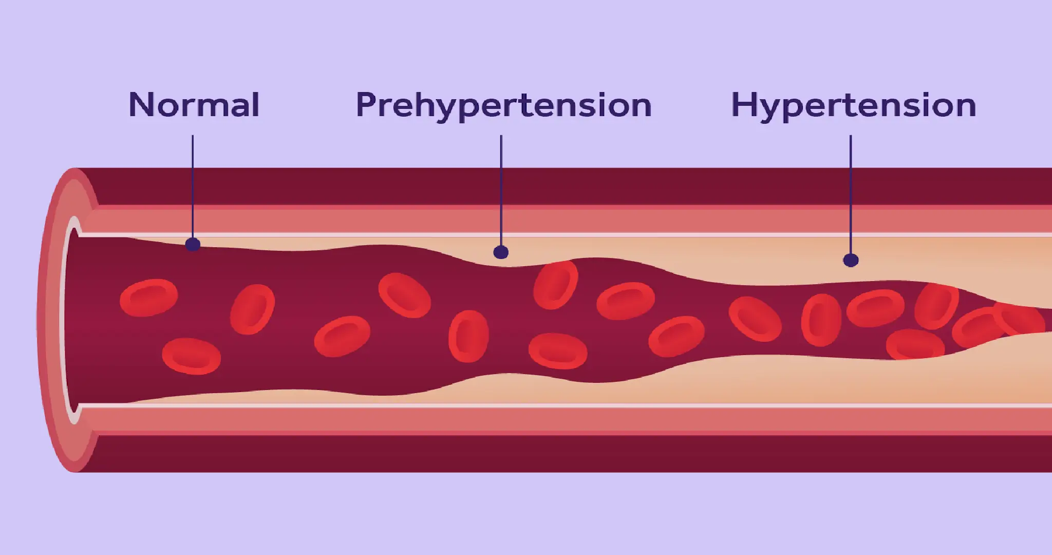 The Hidden Dangers of High Diastolic Blood Pressure and How to Manage ...